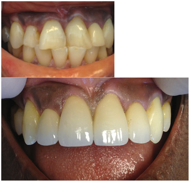 Before & After | Grace Dental